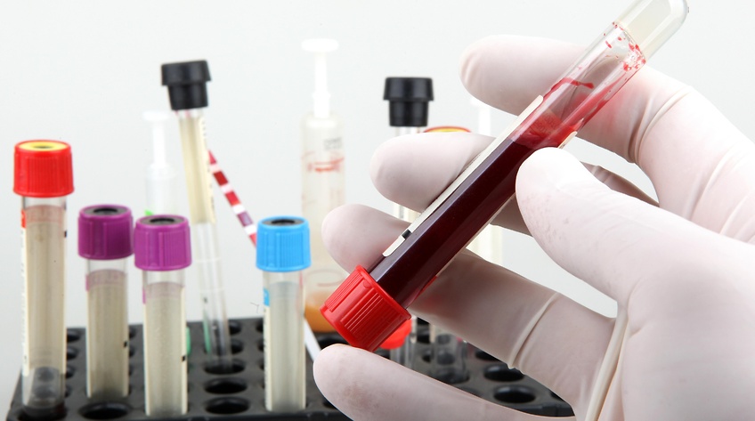 Positivt från Immunicum